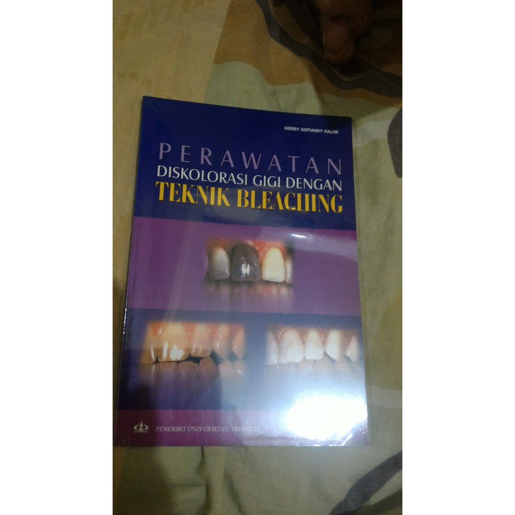 Jual perawatan diskolorasi gigi dengan teknik bleaching Keren | Shopee Indonesia