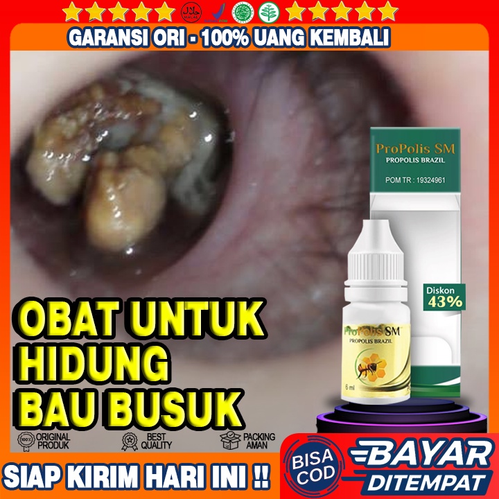 Jual Obat hidung bau busuk, Ingus Kuning Kehijauan, sinusitis akut ...