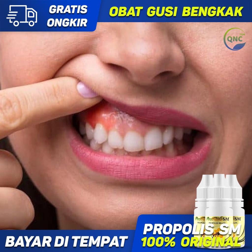 Jual Obat Gusi Bengkak, Sakit Gusi, Sakit Gigi, Bau Mulut - Propolis SM ...
