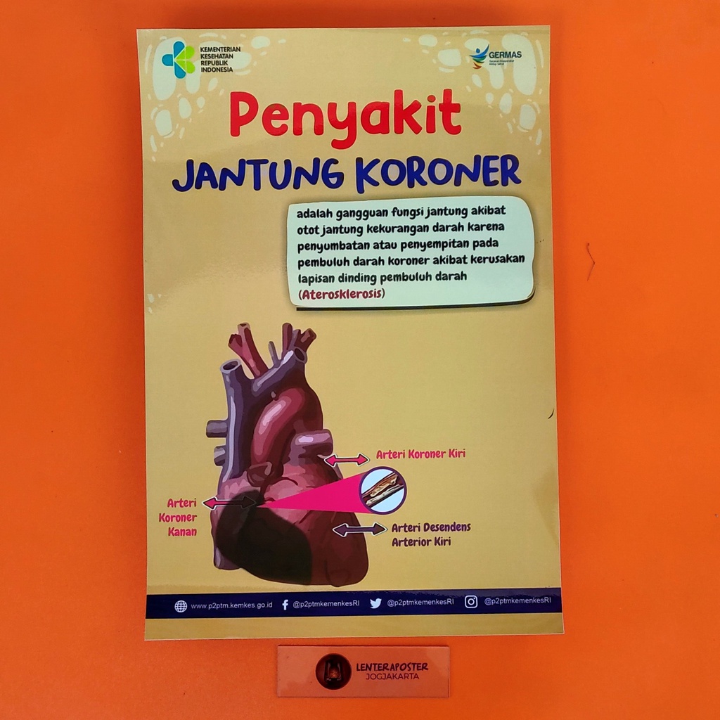 Jual Poster Kesehatan Jantung - Poster Penyait Jantung Koroner. Ukuran ...