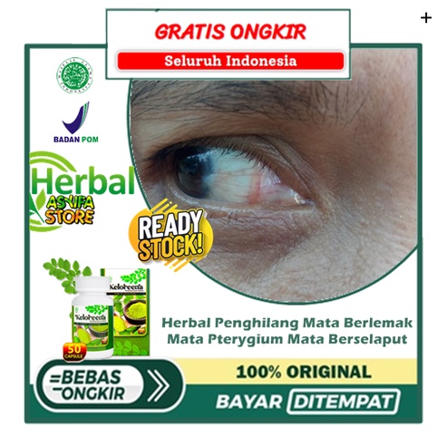 Jual Herbal Penghilang Mata Berlemak Yang Efektif Mata Pterygium Mata Berselaput Mata Glukoma ...