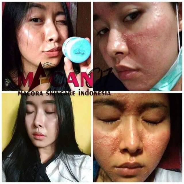 Jual macora skin care | Shopee Indonesia