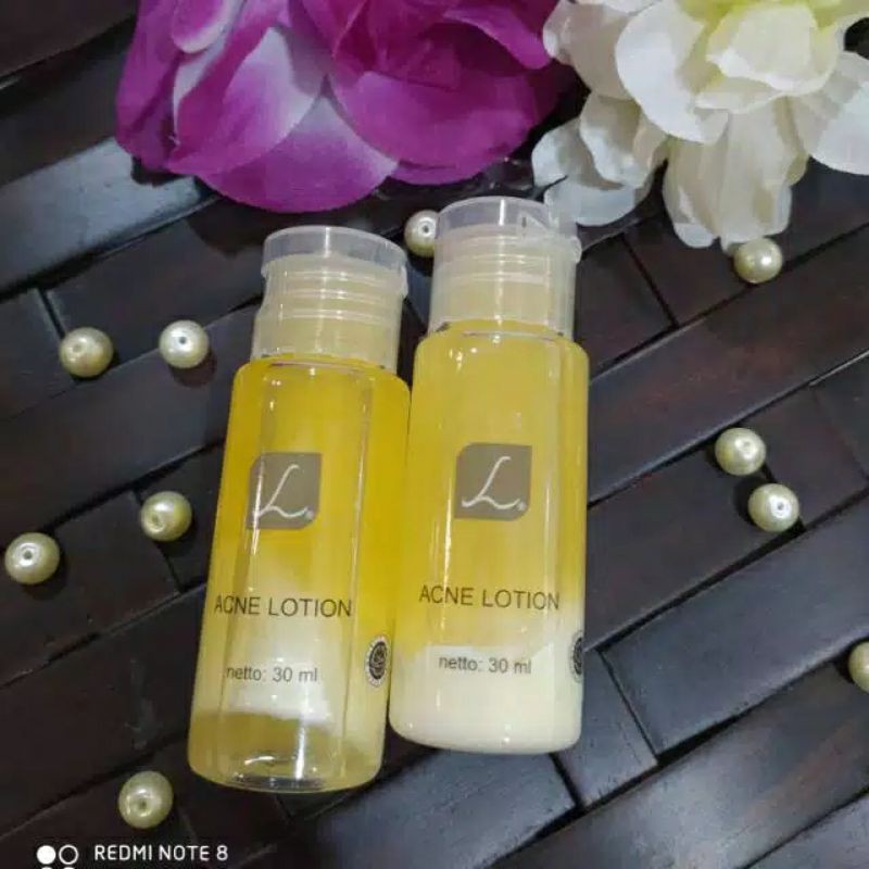 Jual Obat Jerawat / acne lotion Original Larissa | Shopee Indonesia