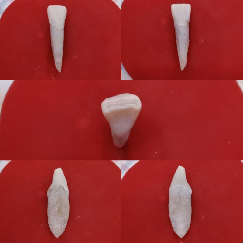 Jual Gigi 42 Gigi Asli Praktikum Gigi Insisif Lateral Kanan Rahang ...