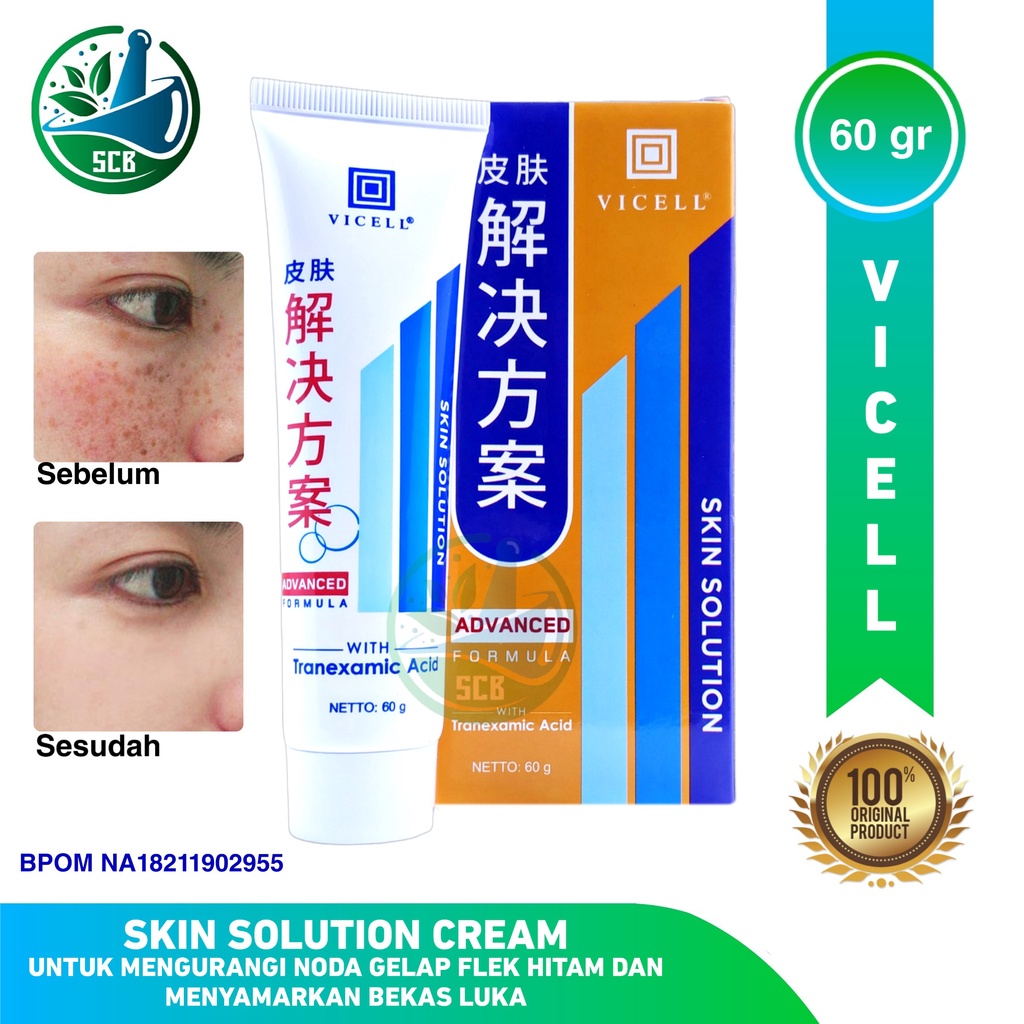 Jual Vicell Skin Solution Cream 60 gr - Menghilangkan Bekas Cacar ...