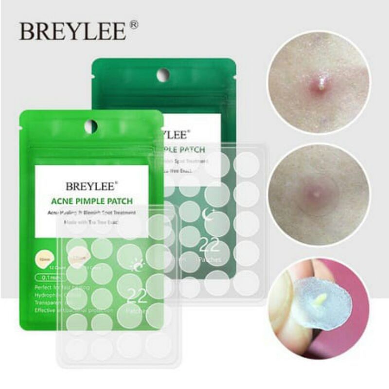 Jual BREYLEE ACNE PIMPLE PATCH DAY AND NIGHT | Shopee Indonesia