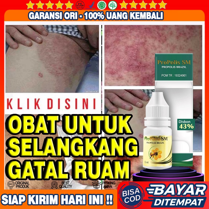Jual Obat Gatal Selangkangan - Gatal Di Area Kelamin - Jamur Di Sela ...