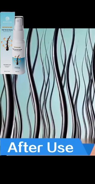 Jual [BPOM] DODOYURI Hair tonic rambut rontok Serum penumbuh rambut ...