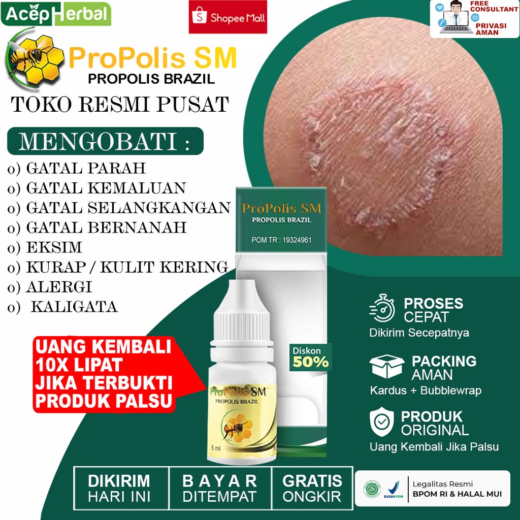 Jual Obat Gatal Kurap Kulit Jamuran Kulit Kering Gatal Eksim Panu Gatal ...