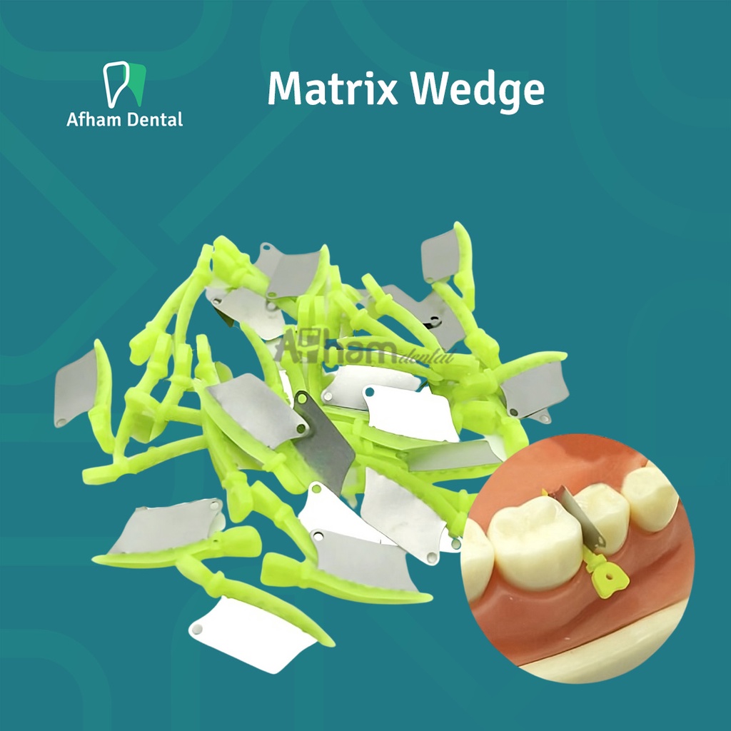 Jual DENTAL MATRIX + WADGE FENDERMATE FENDER MATE / AFHAM DENTAL ...