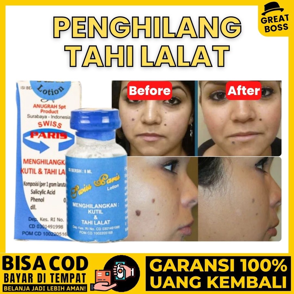 Jual Penghilang Tahi Lalat Swiss Paris Lotion Salep Kutil Tompel Tai ...