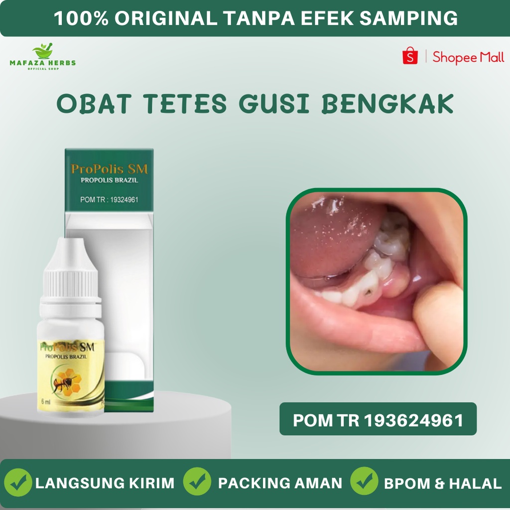Jual Obat Gusi Bengkak, Obat Gusi Bengkak Dan Sakit Gigi, Obat Gusi ...