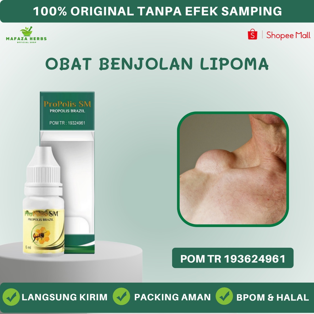 Jual Obat Benjolan Lipoma Kelenjar Getah Bening Tiroid Bengkak Uci Uci ...