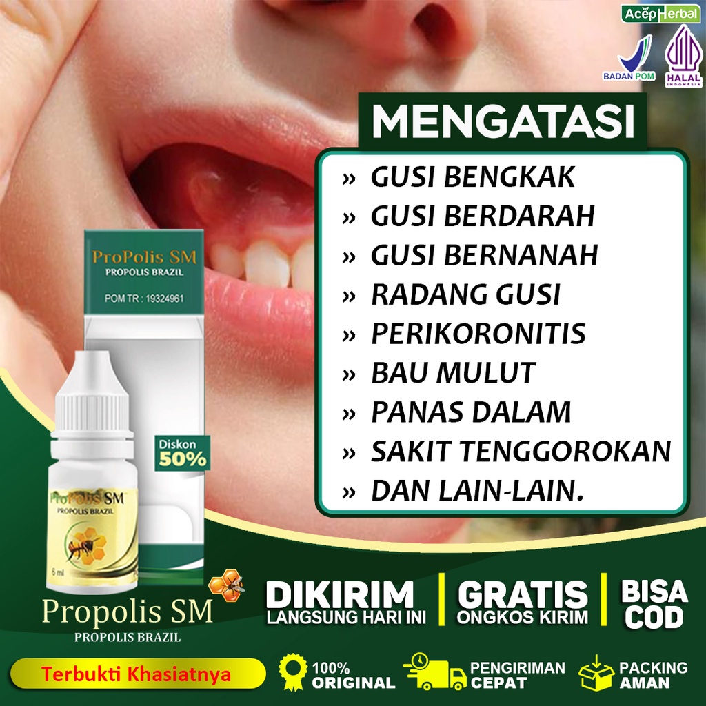 Jual Obat Gusi Bengkak Sakit Gigi Gigi Berlubang Radang Gusi Plak Gigi ...
