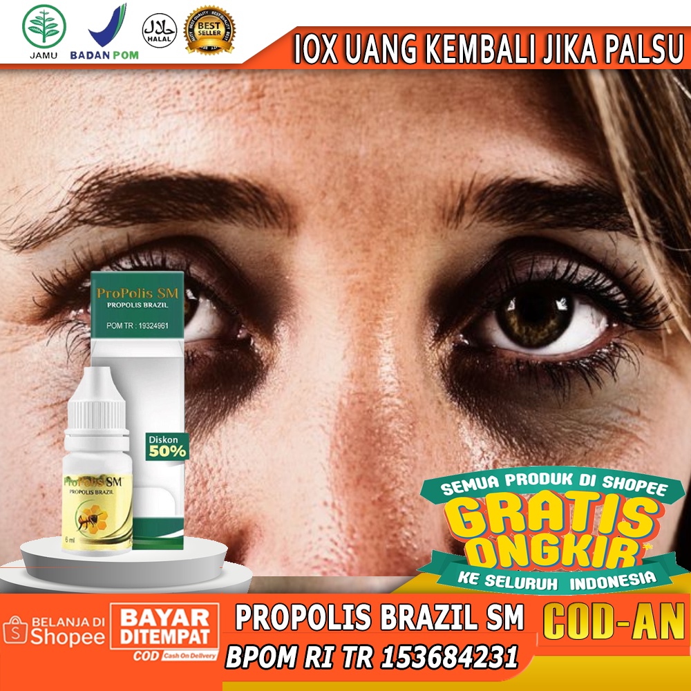 Jual Obat Penghilang Warna hitam di kelopak mata, salep penghilang ...