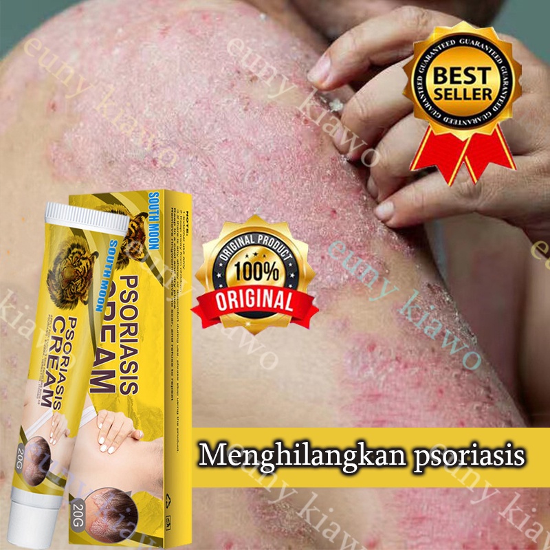 Jual Salep gatal Salep Eksim Salep kulit Krim psoriasis paling ampuh ...