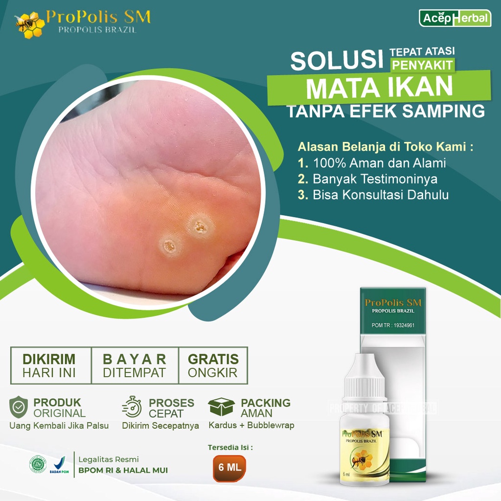 Jual Obat Tetes Mata Ikan Kronis Akut Anak Dan Dewasa Pengering Luka ...