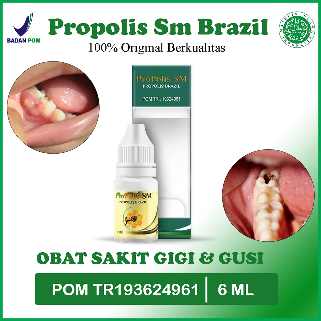 Jual Obat Gusi Bengkak Karena Gigi Berlubang Yang Aman Dan Efektif Untuk Mengurangi Pembengkakan ...