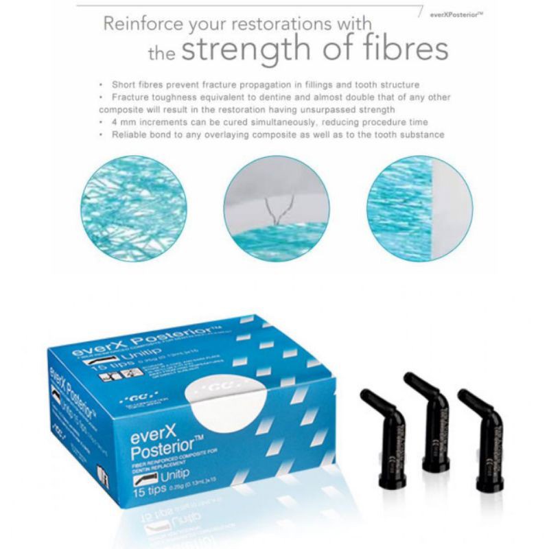 Jual GC everX ever x ecer fiber posterior composite restoration tips ...