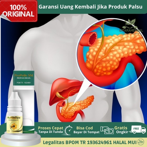 Jual Obat pankreatitis, Obat Radang Pankreas, Obat Pankreatitis Akut ...