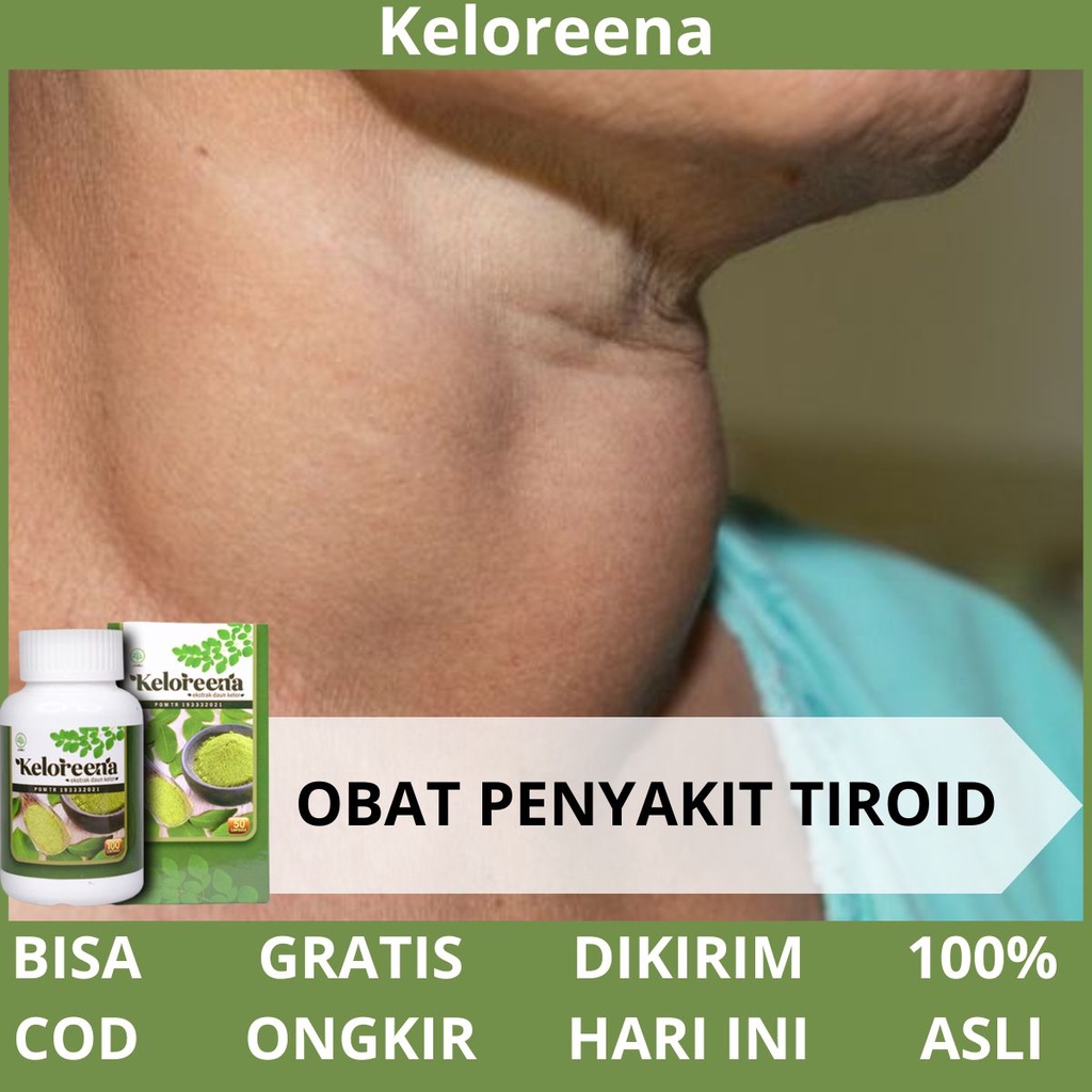 Jual Obat Kelenjar Tiroid Di Leher - Obat Penyakit Benjolan Tiroid ...