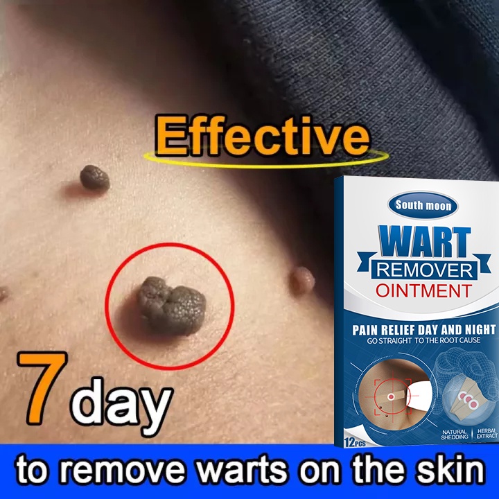 Jual [COD ] Krim kutil、Wart Removal Patch、tempelan keyou、tempelan kutil ...