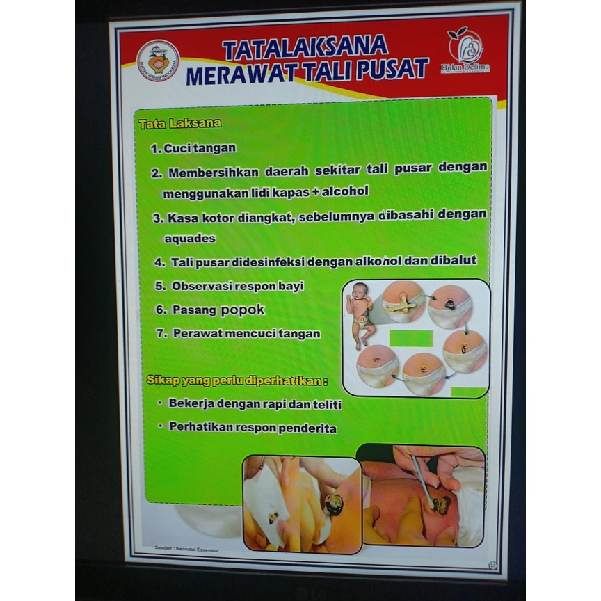 Jual NO 37 POSTER TATALAKSANA MERAWAT TALI PUSAT | Shopee Indonesia