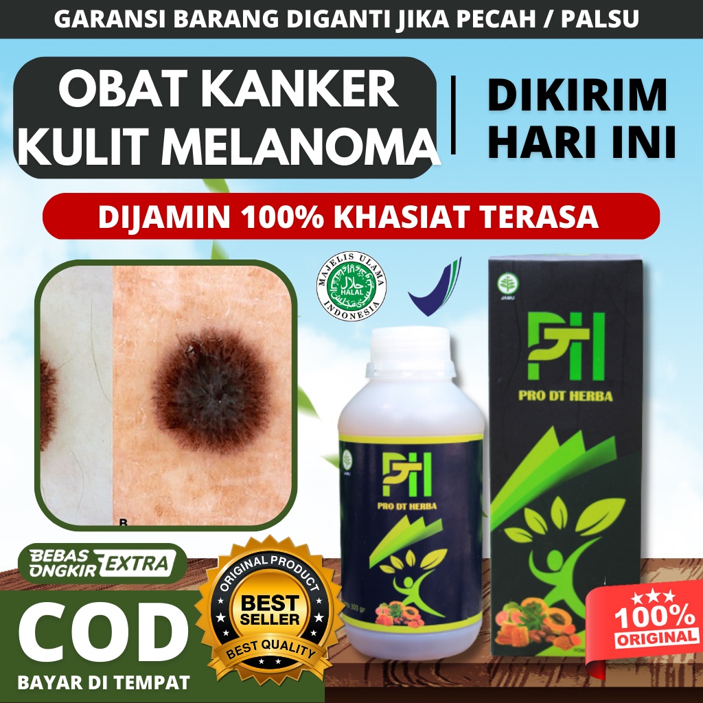 Jual Pro DT Herba Original - Obat Kanker Kulit Melanoma Paling Ampuh ...