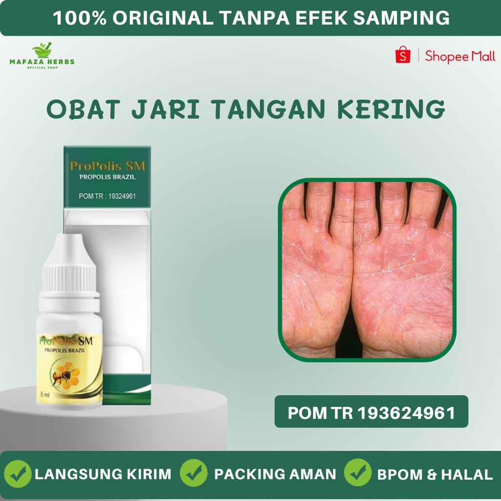 Jual Mafaza Herbs - Obat Jari Tangan Kering Dan Pecah, Obat Telapak ...