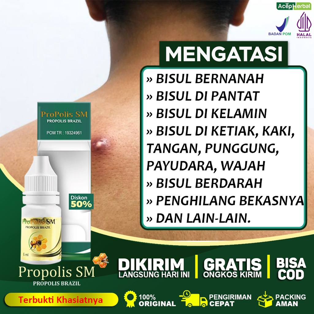 Jual Obat Bisul Bernanah Bisul Bengkak Bisul Pecah Berdarah Obat Tetes ...