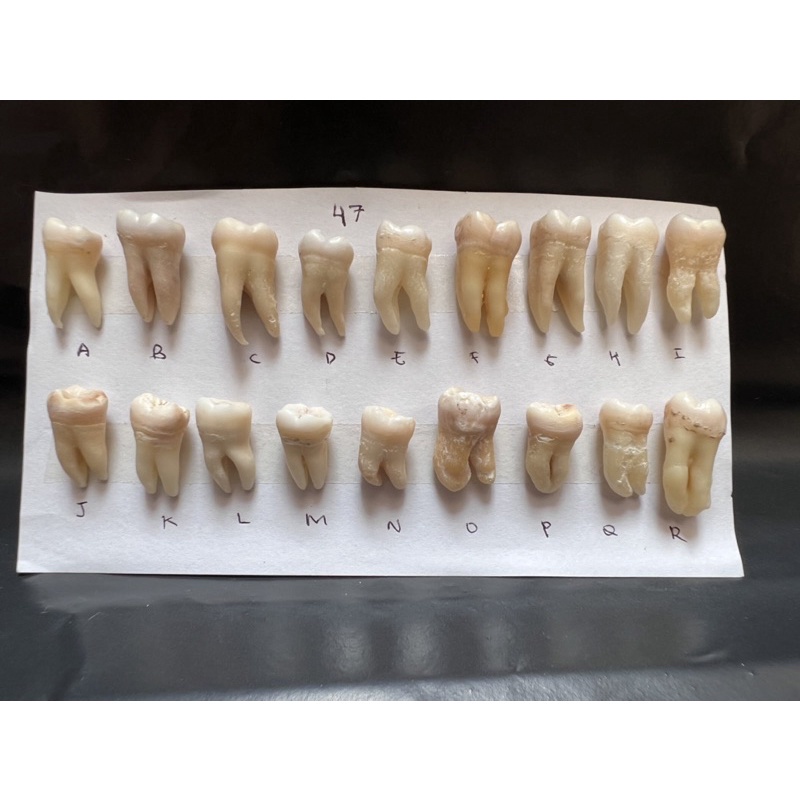 Jual Gigi 47 / gigi molar rahang bawah | Shopee Indonesia