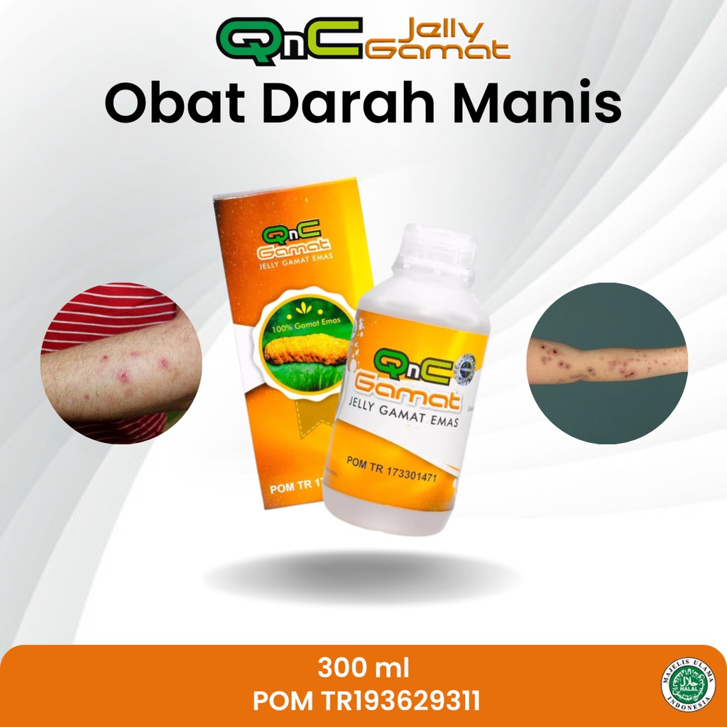 Jual Obat Darah Manis, Prurigo, Bintik Bintik Di Kulit, Bekas Luka ...