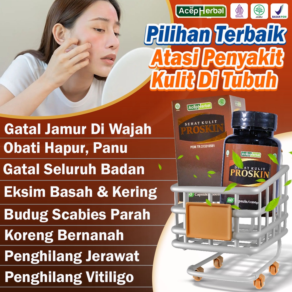 Jual Obat Balas Bogo Gatal Jamur Kulit di Wajah Paling Alami untuk ...