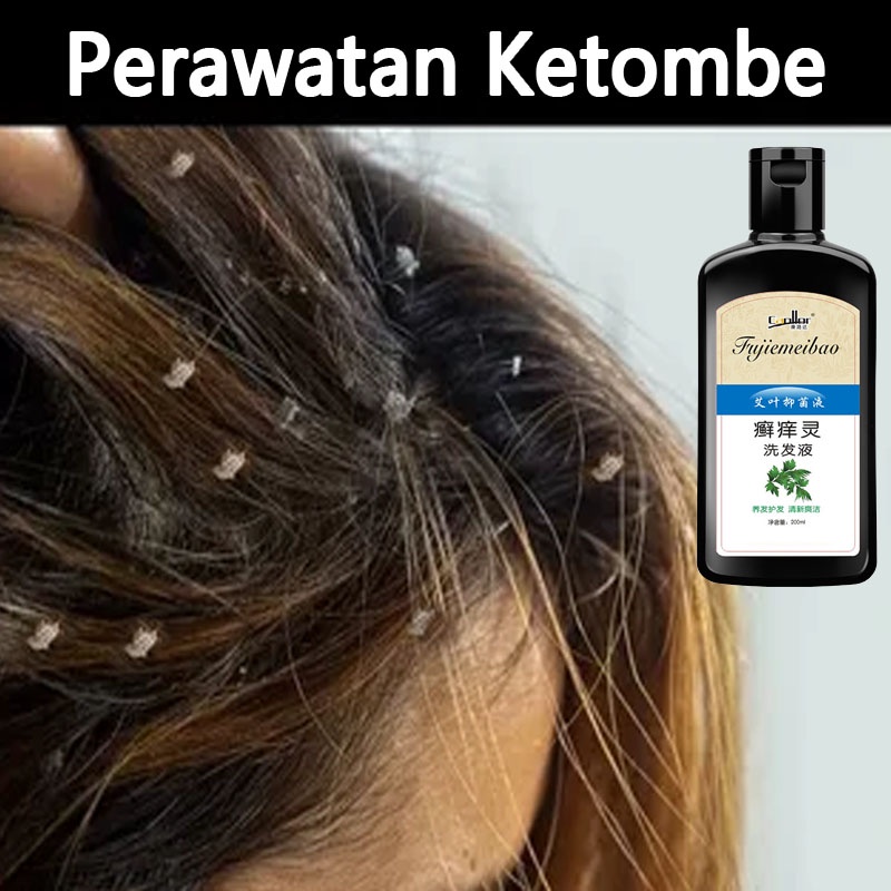 Jual sampo anti ketombe shampo anti ketombe gatal anti ketombe anti bakteri shampoo tungau ...