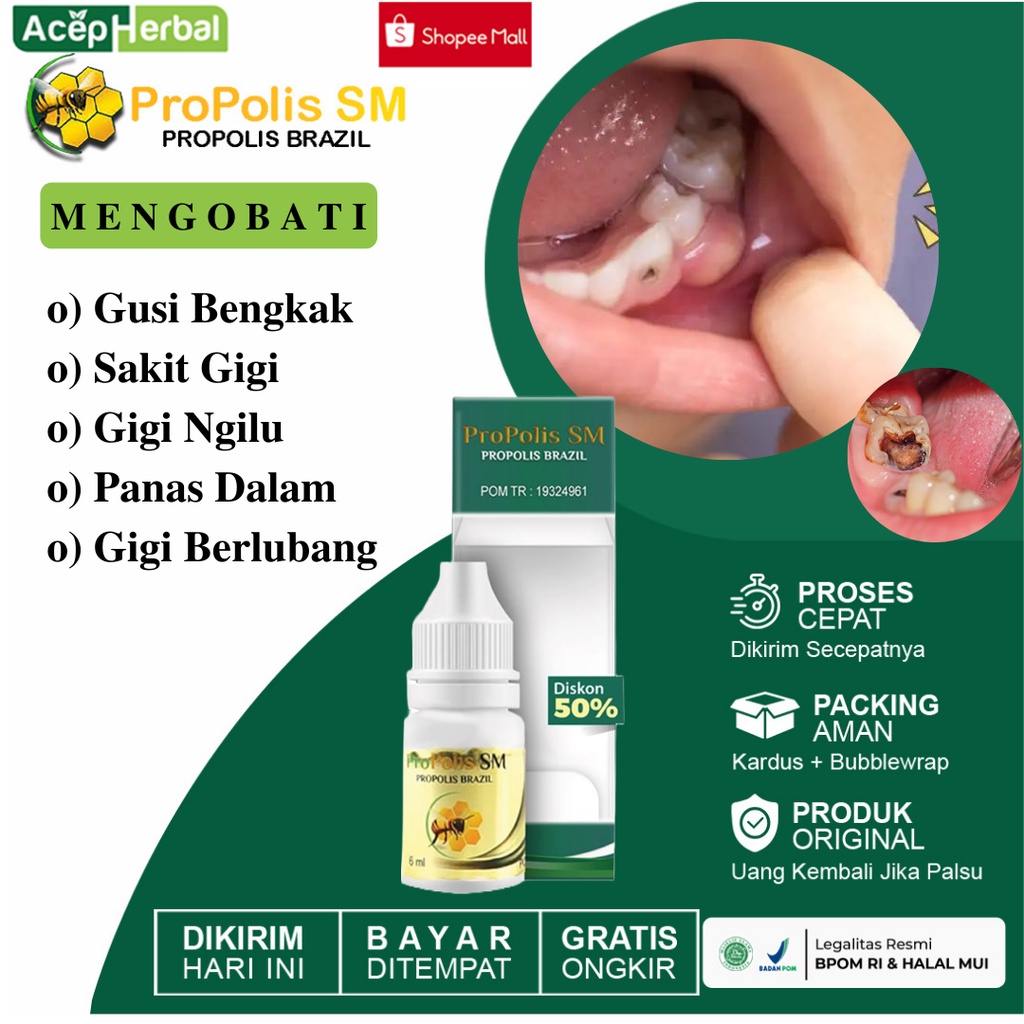 Jual Obat Gusi Bengkak, Sakit Gigi, Gigi Ngilu, Panas Dalam, Gigi ...