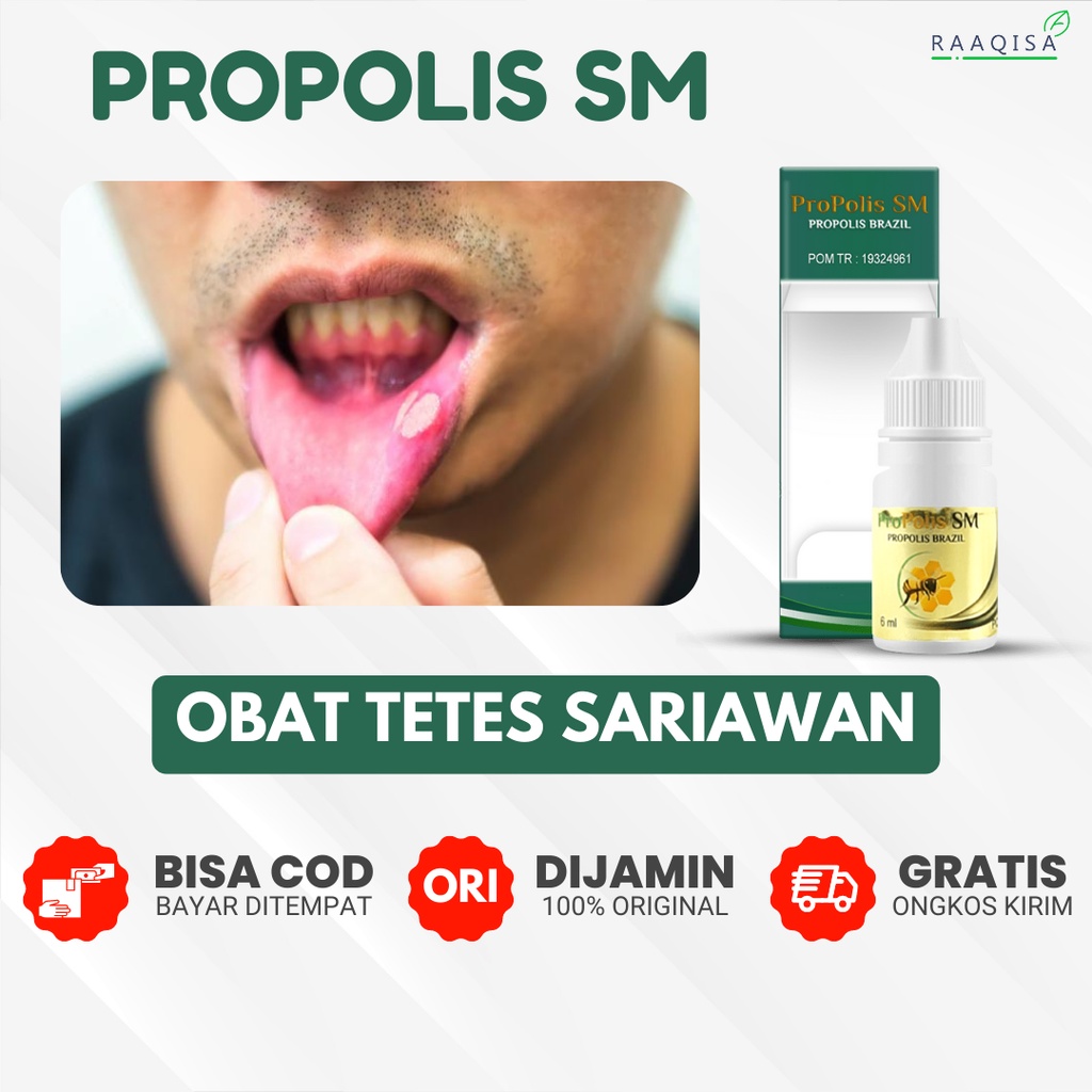 Jual Obat Sariawan Parah Radang Sariawan Sariawan Di Tenggorokan Sariawan Di Lidah Sariawan