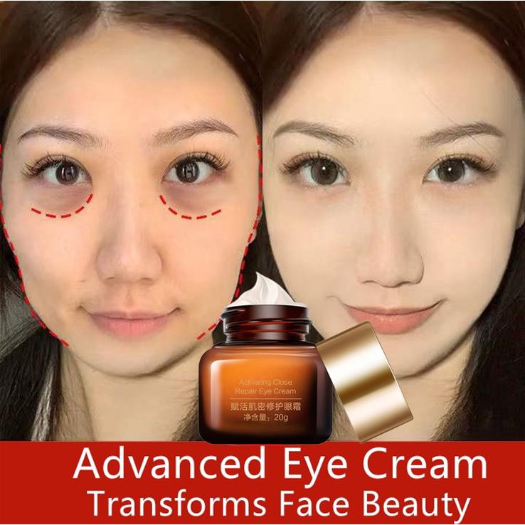 Jual 【Local spot】Eye Cream activating close repair eye cream Lingkaran ...