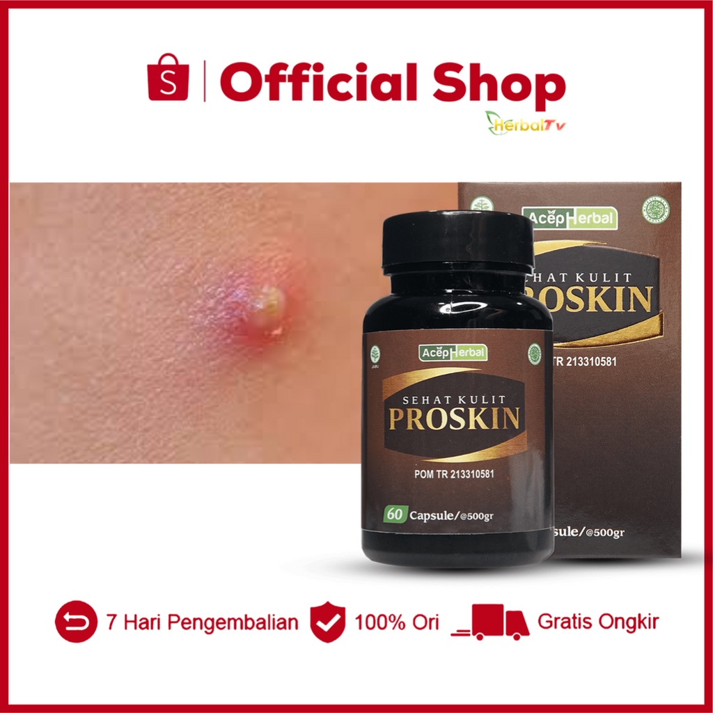 Jual Obat Cenang di tubuh bernanah, gatal atasi dengan proskin kapsul ...