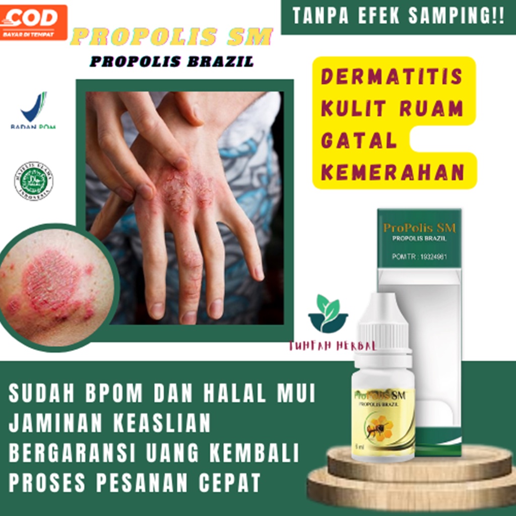 Jual Obat Dermatitis Alergi Kulit Ruam Kemerahan, kulit gatal, kering ...