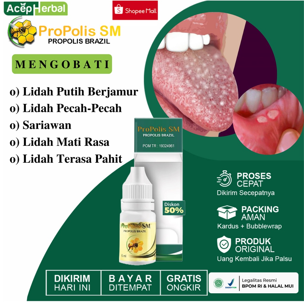 Jual Obat Lidah Putih Berjamur Lidah Pecah Pecah Sariawan Mati Rasa ...