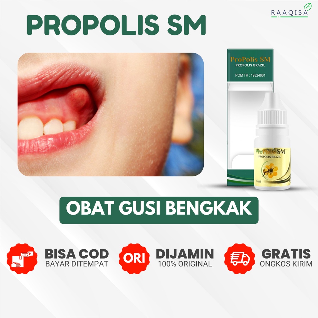 Jual Obat Gusi Bengkak, Bisul di Gusi, Gusi Menonjol, Gusi Memerah ...