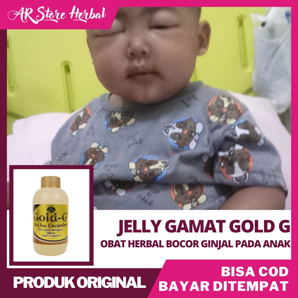 Jual Obat Ginjal Bocor, Sindrom Nefrotik, Bocor Ginjal, Ginjal Bocor ...