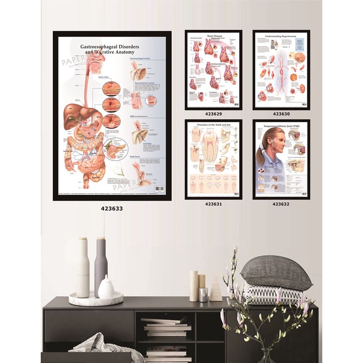 Jual Poster Kedokteran / Kesehatan / Gastroesophageal Disorders ...