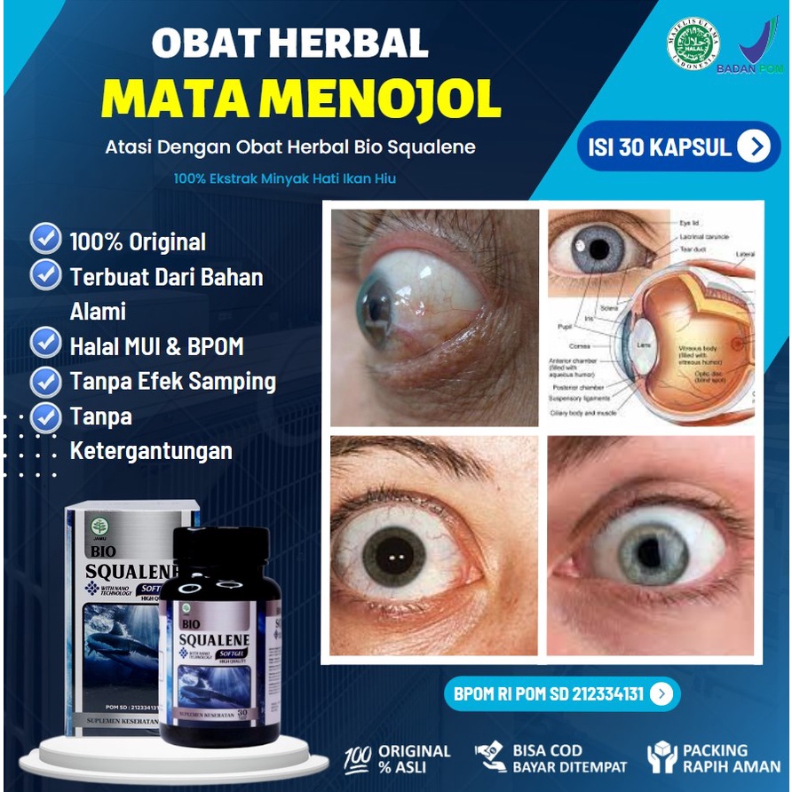 Jual Obat Kelainan Mata Menonjol Akibat Hipertiroid, Obat Proptosis ...