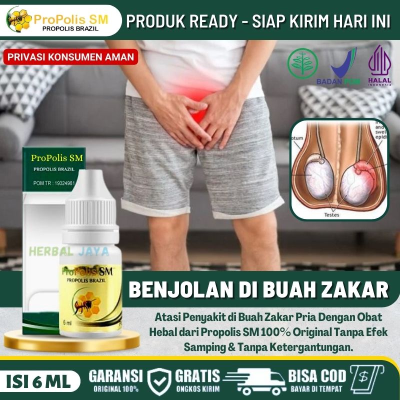 Jual Salep Benjolan di Testis Pria, Salep Alami Penghilang Benjolan ...