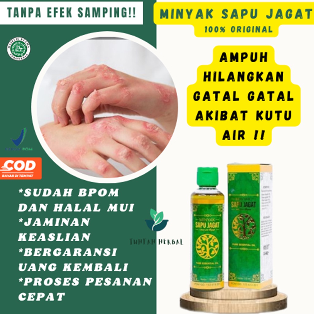 Jual Obat Gatal Kutu Air Kuman Air Jamur Kutu Air Kutu Air di Badan ...
