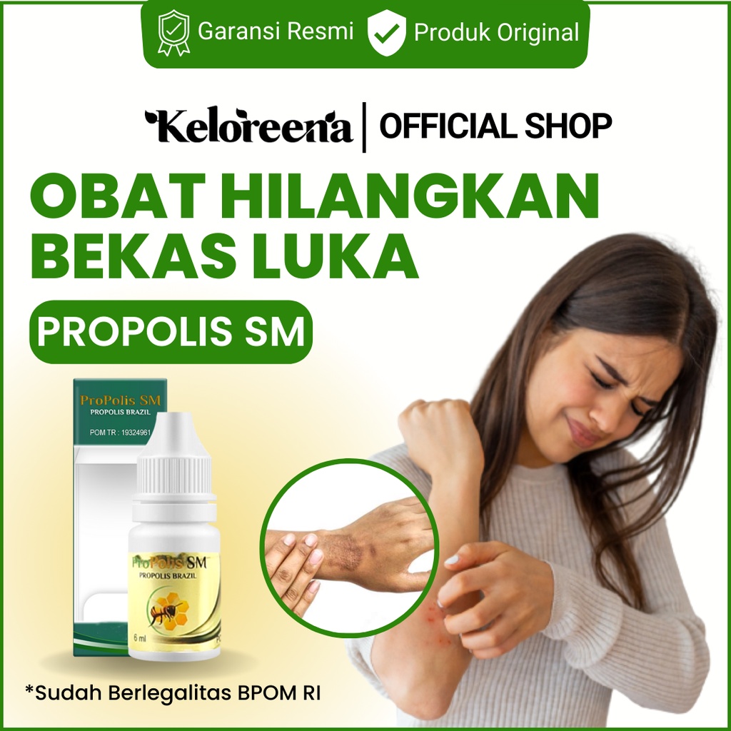 Jual Obat Luka Bekas Koreng Penghilang Jerawat Lama Keloid Bakar Hitam ...