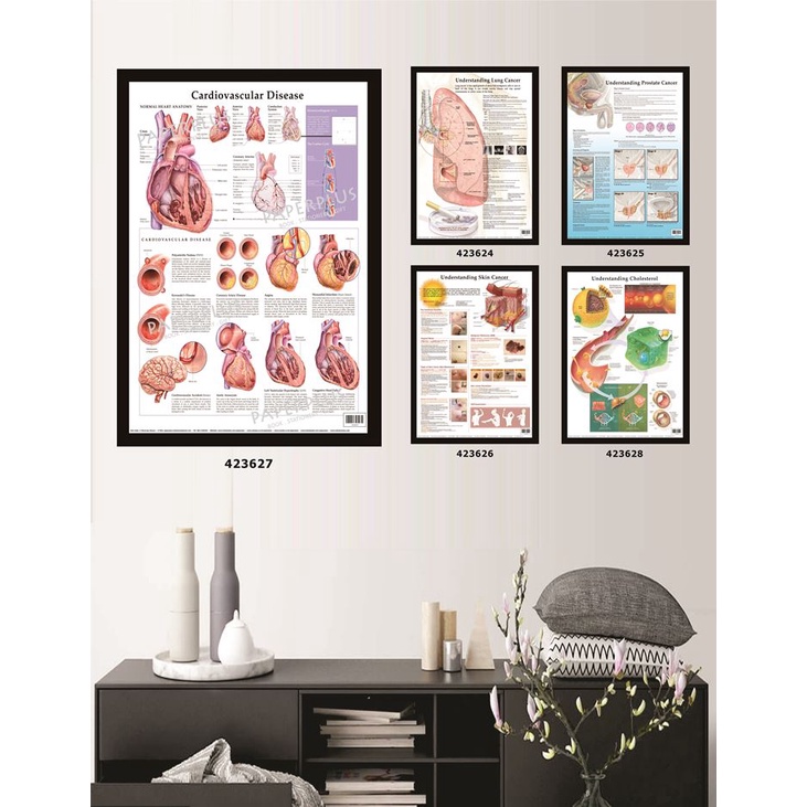 Jual Poster Kedokteran / Kesehatan / Cardiovaskular Disease / 88 ...