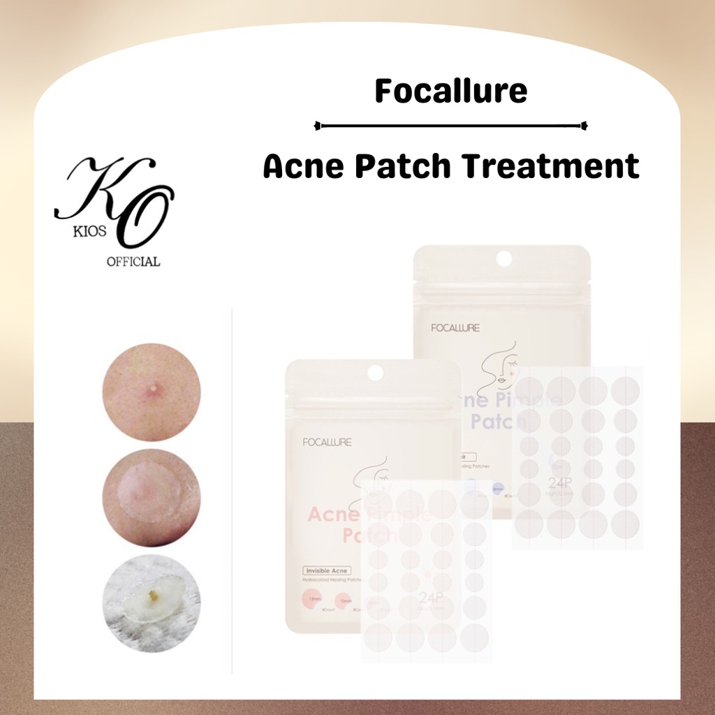 Jual Focallure Spot Acne Patch Treatment Day/Night Waterproof Smooth ...