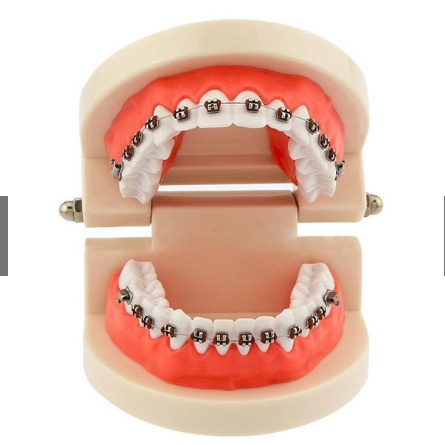 Jual Dental model ortho study model orthodontic phantom studi behel ...